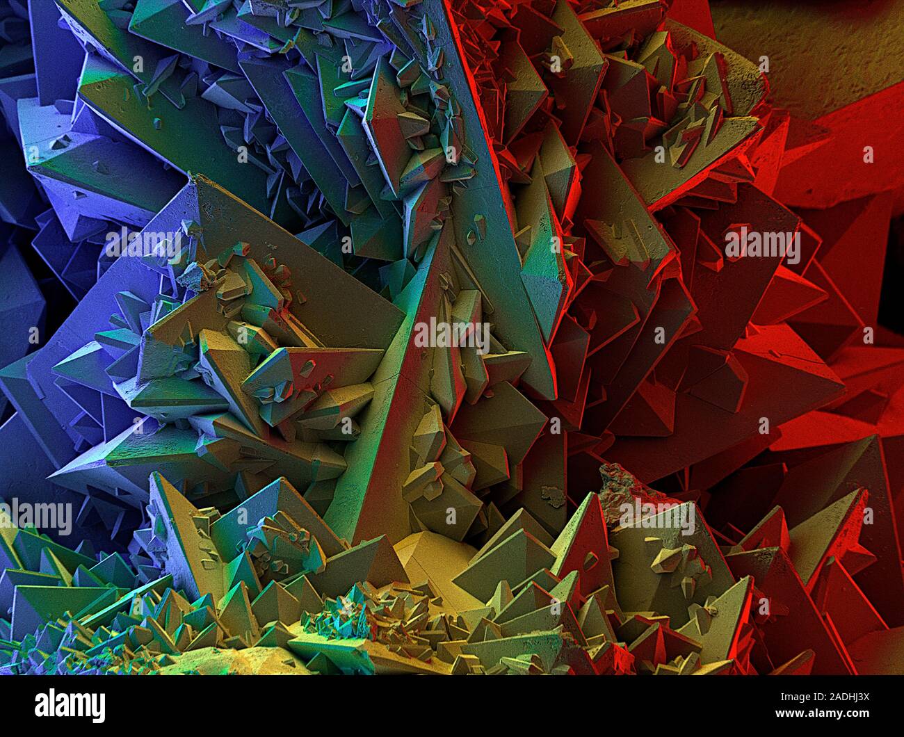 Kidney stone. Coloured scanning electron micrograph (SEM) of the ...