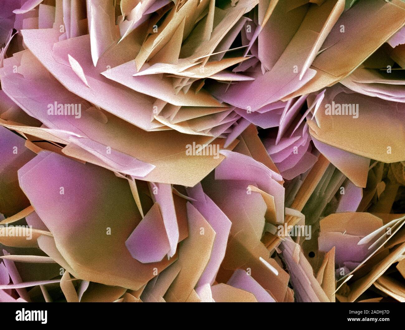 Kidney stone crystals, coloured scanning electron micrograph (SEM ...