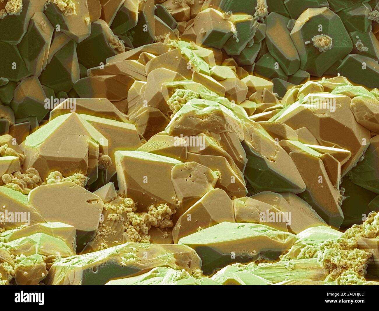 Bladder stone. Coloured scanning electron micrograph (SEM) of the ...