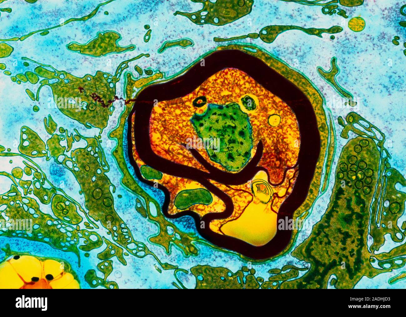 Leprosy. Coloured transmission electron micrograph (TEM) of a section ...