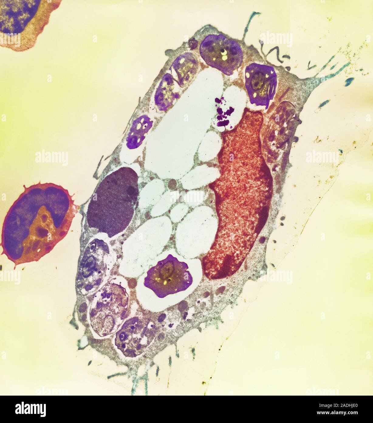 Leishmania protozoa. Coloured transmission electron micrograph (TEM) of ...