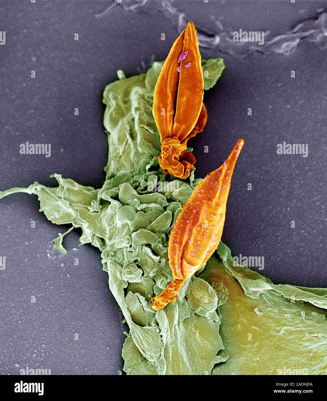 Protozoan infecting macrophage. Coloured scanning electron micrograph ...