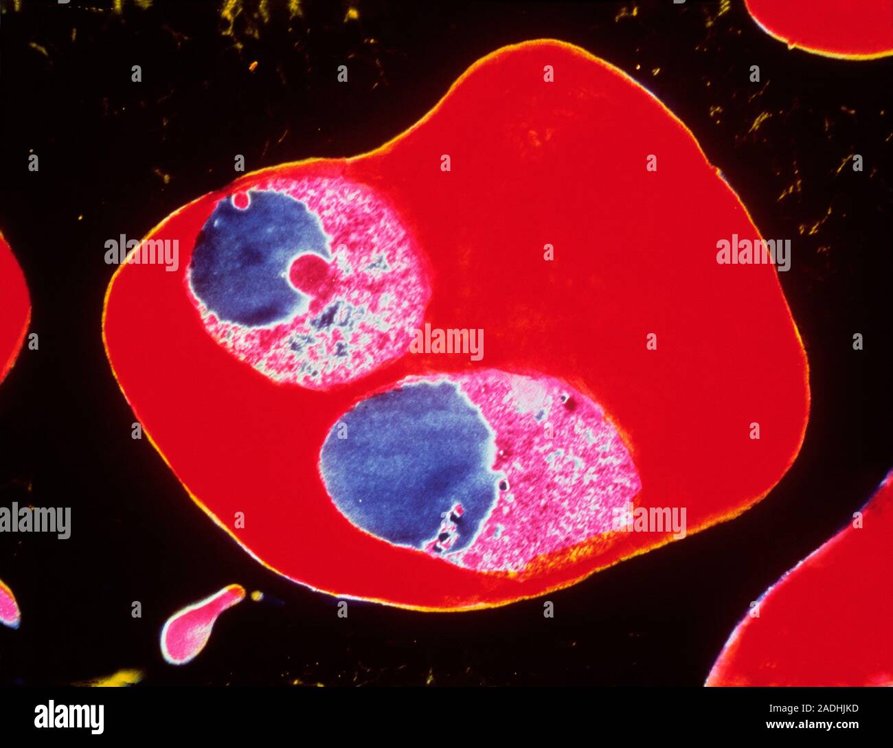 False-colour transmission electron micrograph (TEM) of two merozoites ...