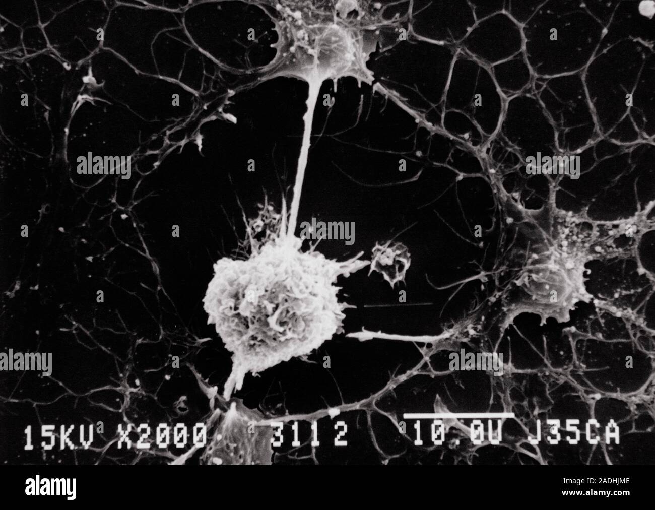 Multiple sclerosis. Scanning electron micrograph of a microglial cell ...