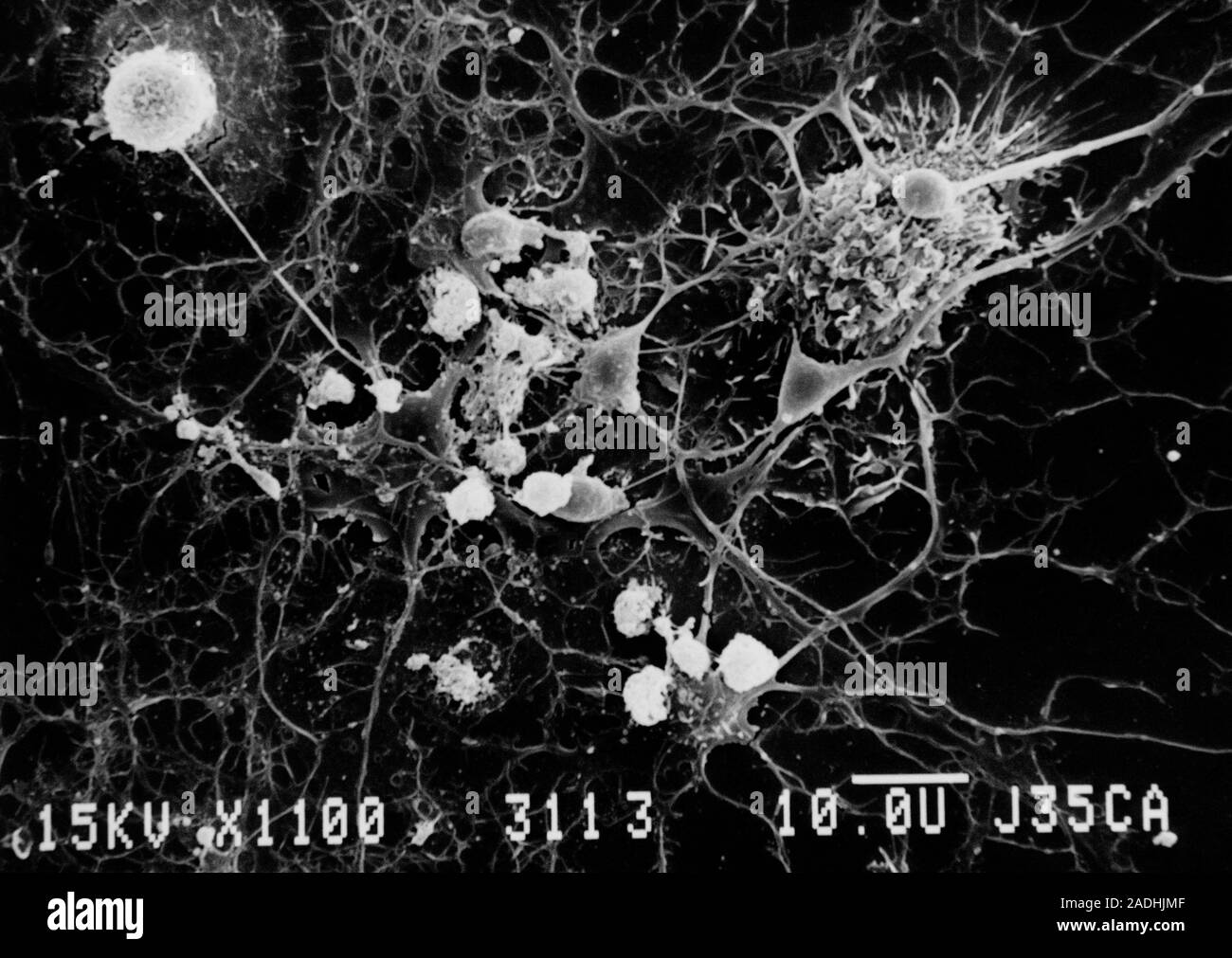 Multiple sclerosis. Scanning electron micrograph of microglial cells ...
