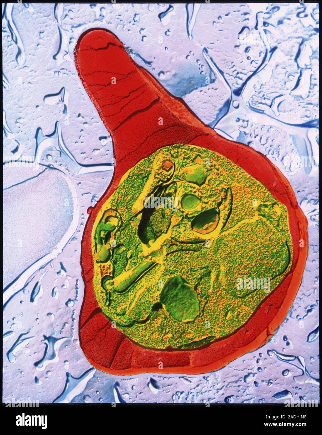 Malaria. Coloured freeze-fractured transmission electron micrograph ...