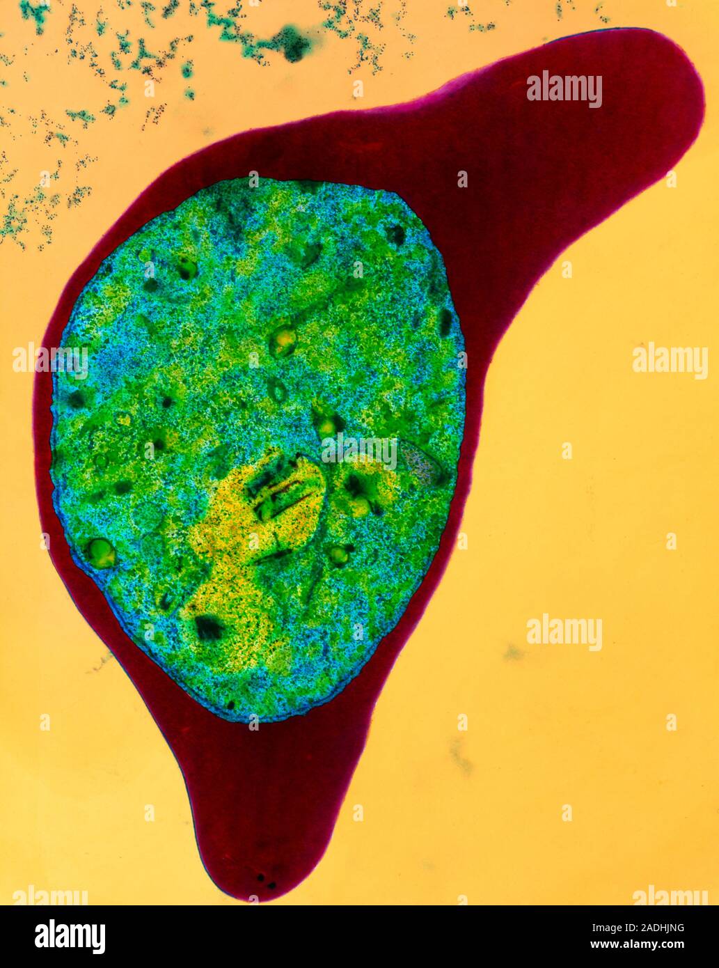 Malaria. Coloured transmission electron micrograph (TEM) of a section ...