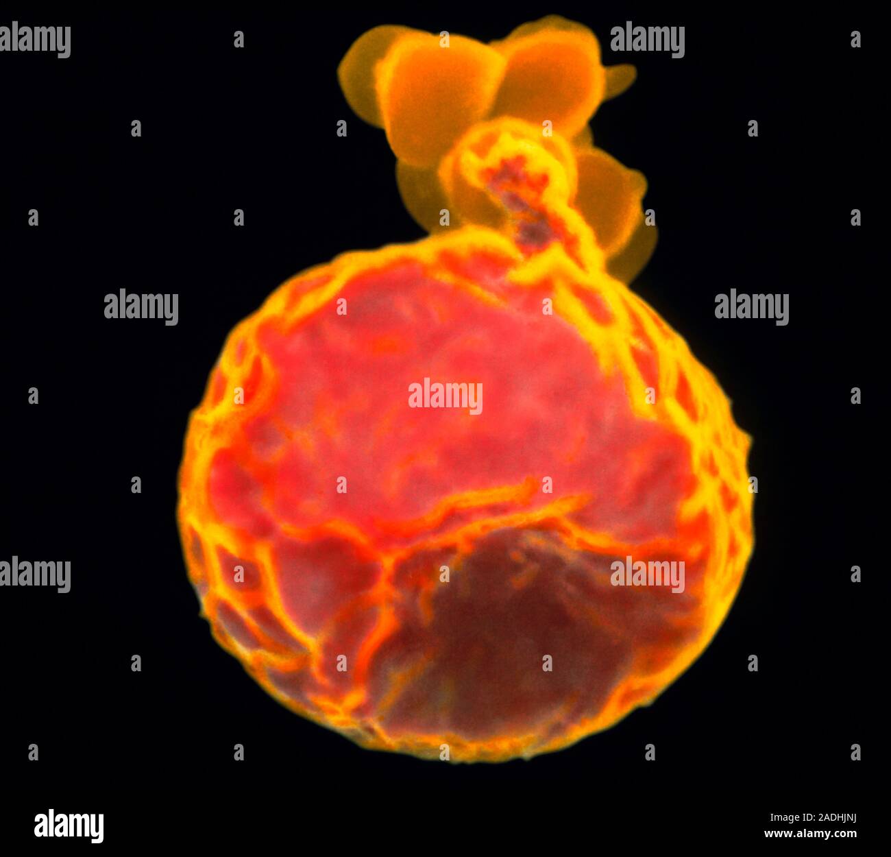 Malaria. Coloured scanning electron micrograph (SEM) of a human red ...