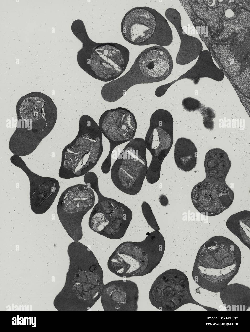 Malaria-infected erythrocytes. Transmission electron micrograph of a ...