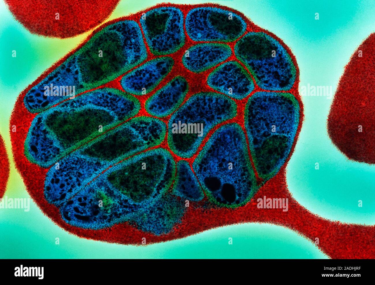 Malaria. Coloured transmission electron micrograph (TEM) of a human red ...