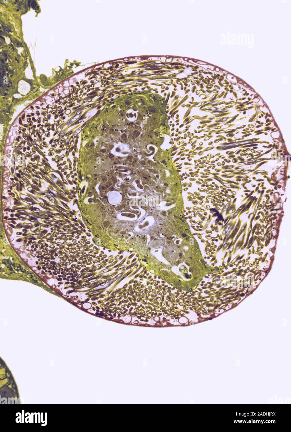 Malaria parasites. Image 8 of 10. Coloured transmission electron ...