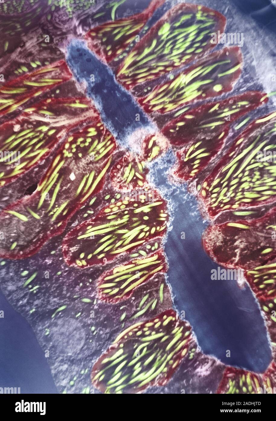 Malaria parasites. Image 10 of 10. Coloured transmission electron ...