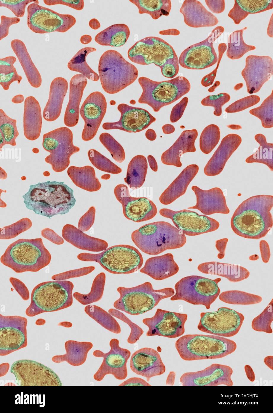 Malaria parasites. Coloured transmission electron micrograph (TEM) of ...