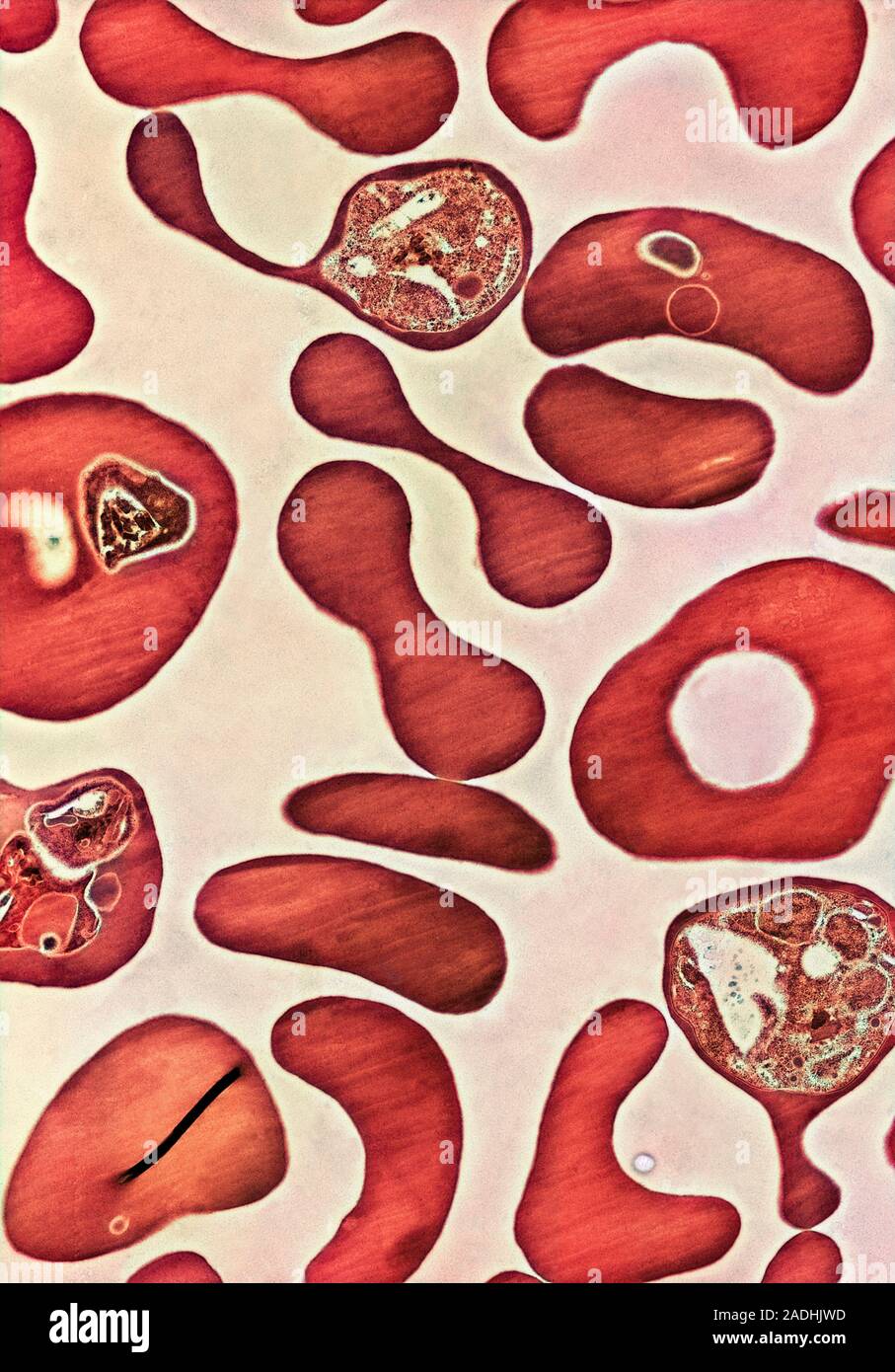 Malaria parasites. Coloured transmission electron micrograph (TEM) of ...