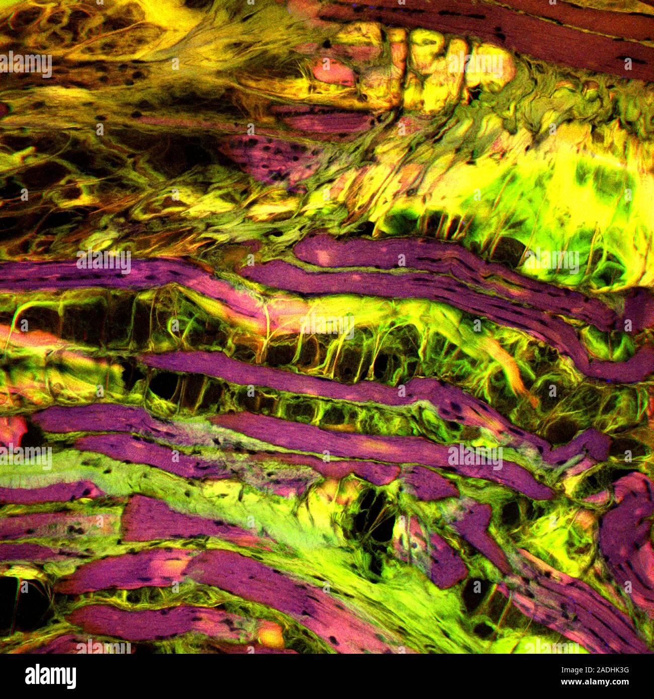 Muscular dystrophy. Confocal light micrograph images of a section ...