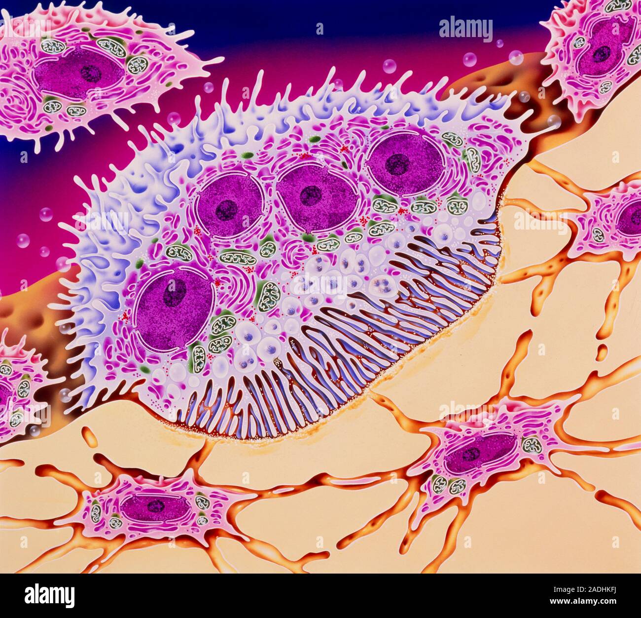 Process of osteoporosis. Illustration of an osteo- clast bone cell in ...