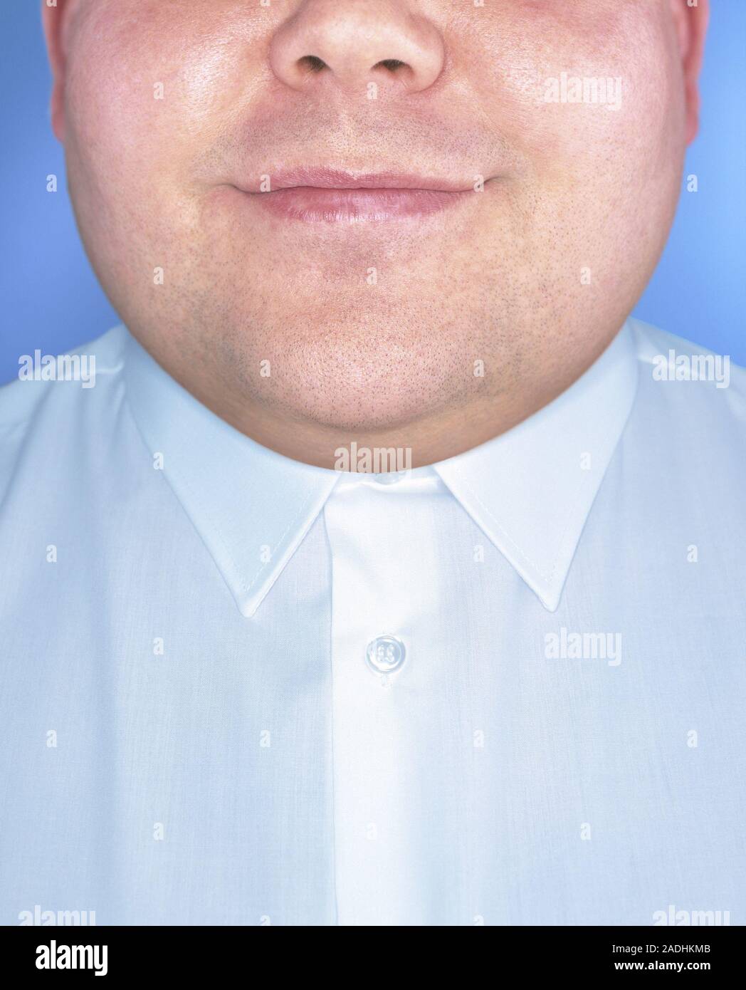 Double chin of an obese man Stock Photo - Alamy