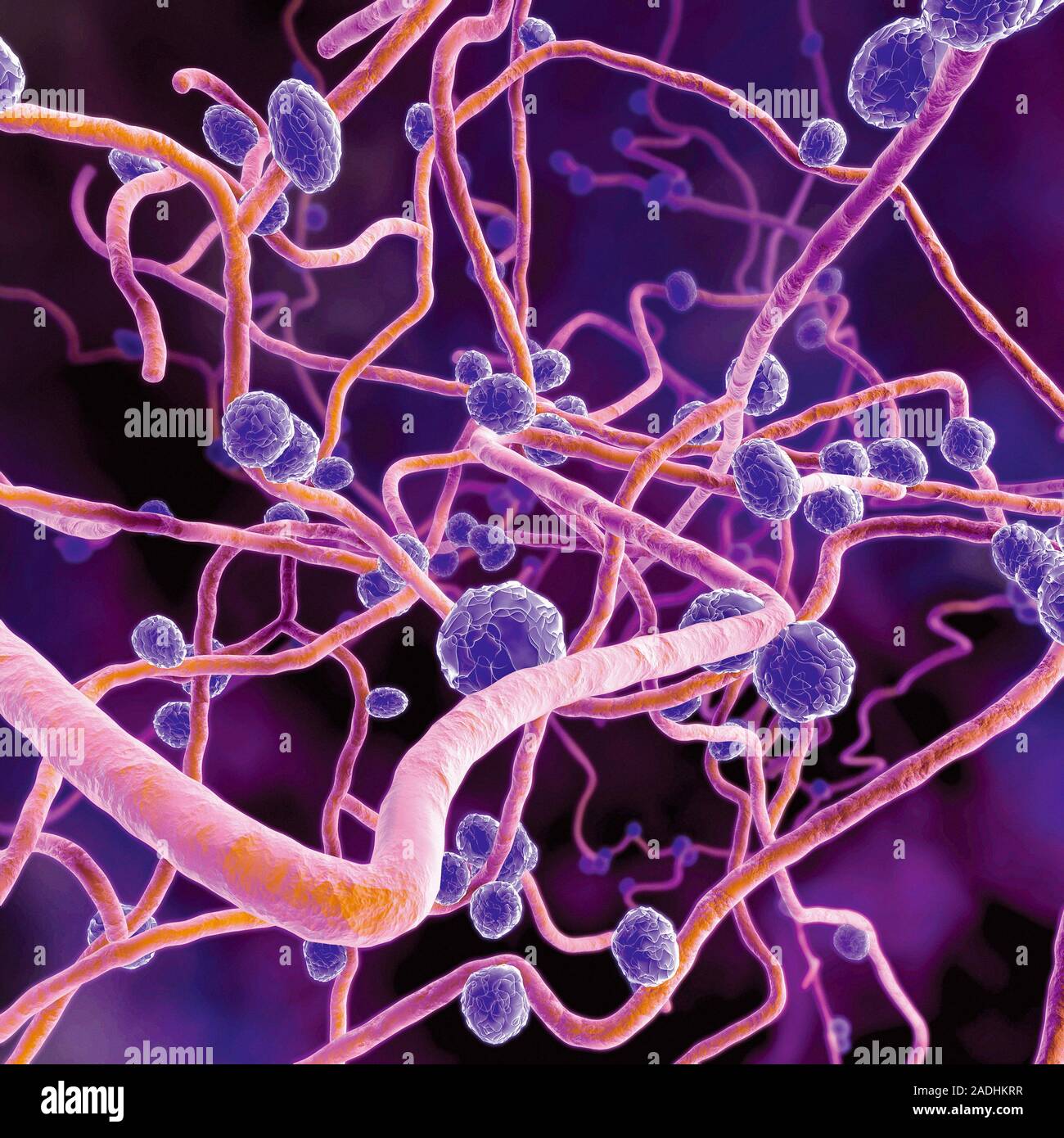 Fungal infection. Computer artwork of hyphae (threads) and fruiting ...