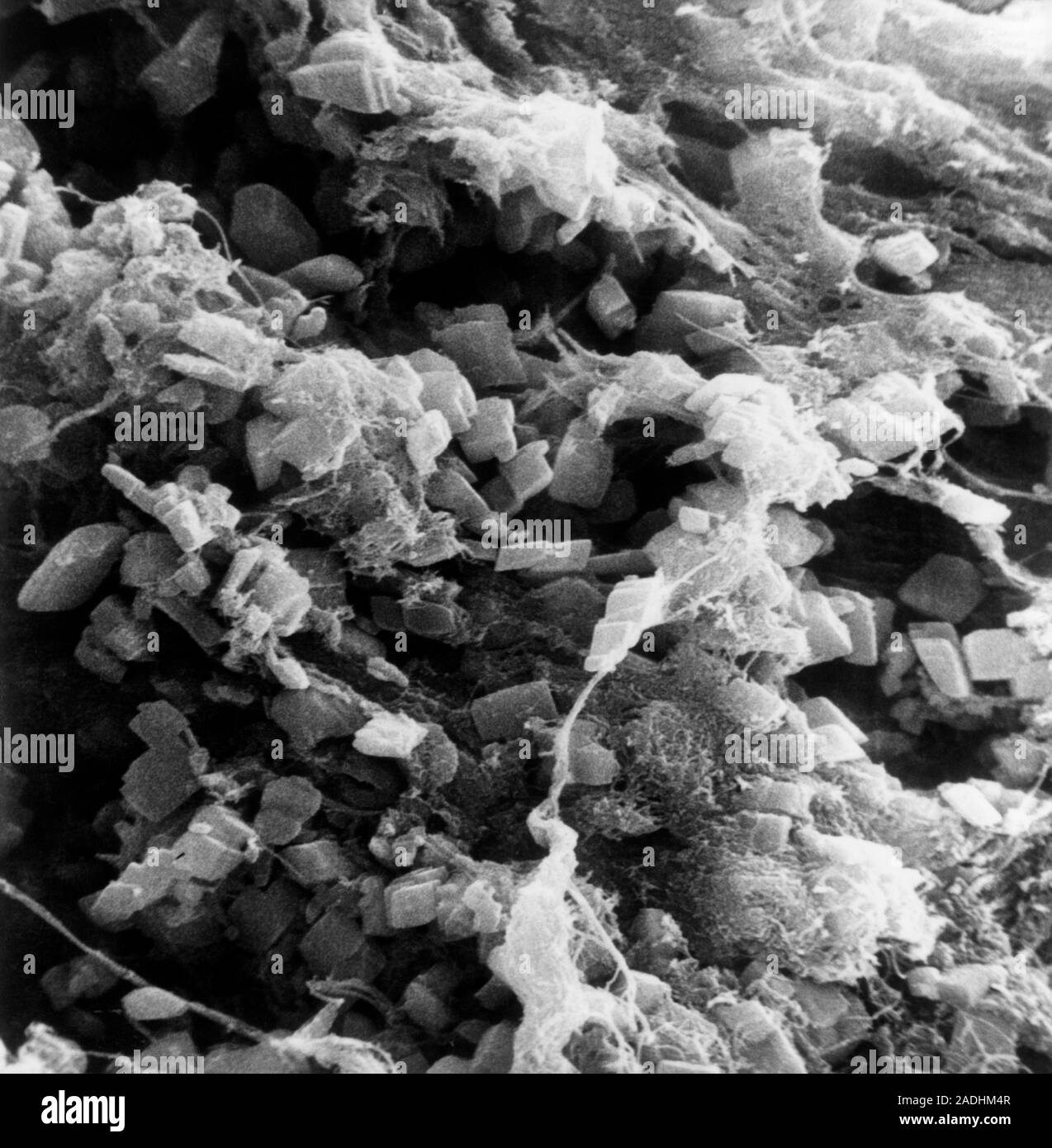 Scanning electron micrograph of a section of calcified meniscus of the ...