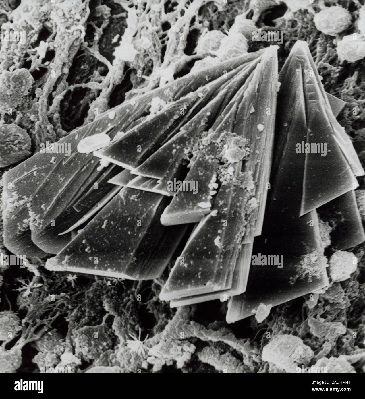 Scanning electron micrograph of crystals of calcium phosphate on the ...