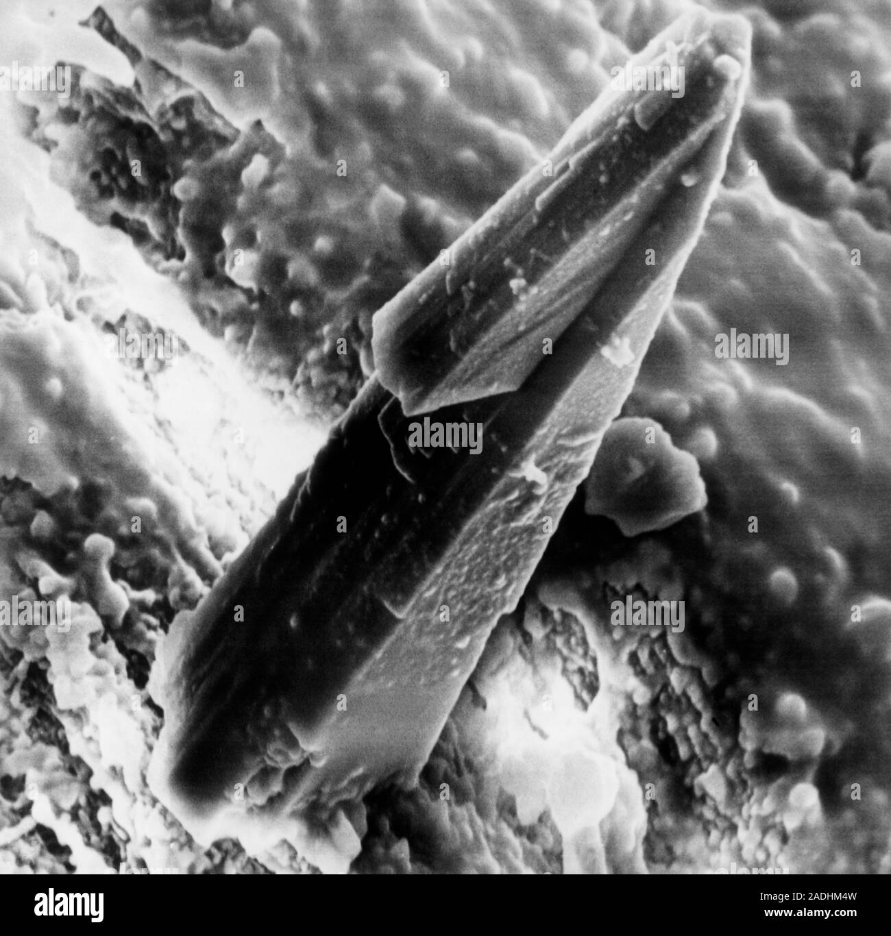 Scanning electron micrograph of crystals of calcium phosphate on the ...