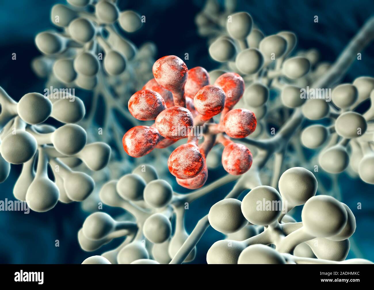 Pulmonary infection. Computer artwork of inflamed alveoli (red), caused ...