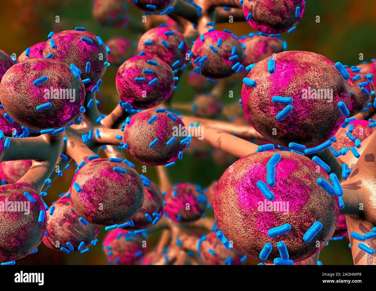 Bacterial lung infection. Computer artwork of rod- shaped bacteria ...
