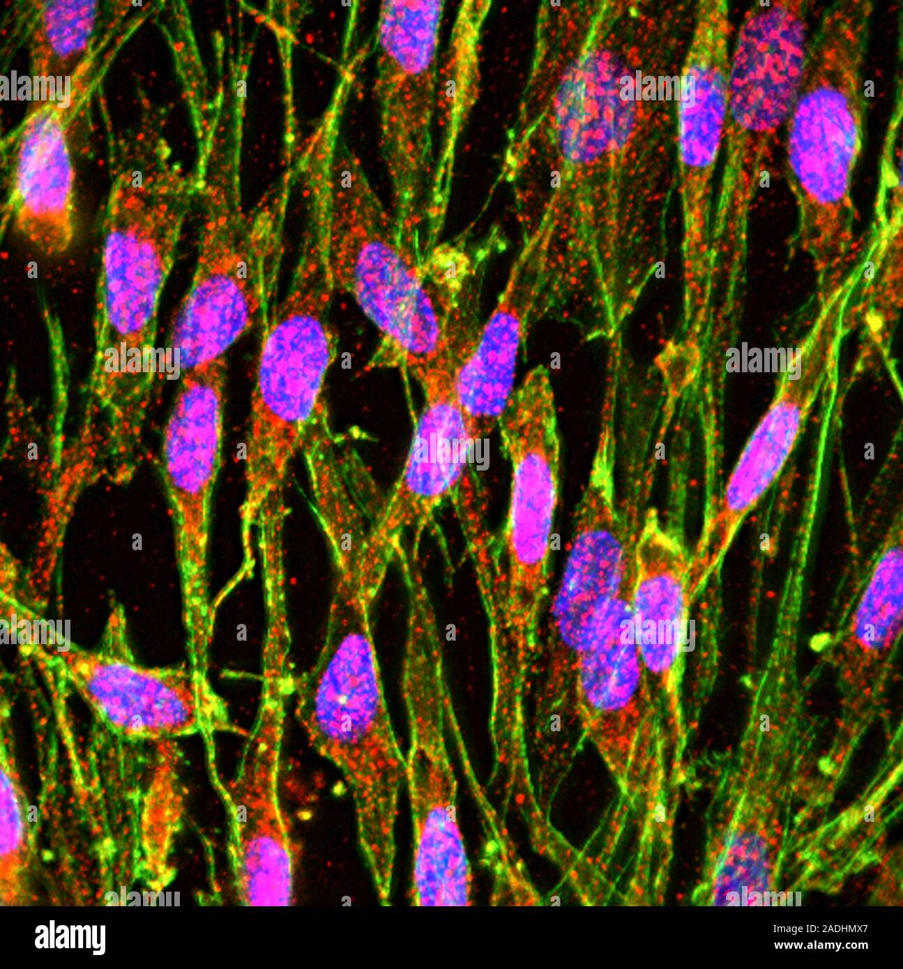 Brain protein in Parkinson's research, fluorescence deconvolution ...