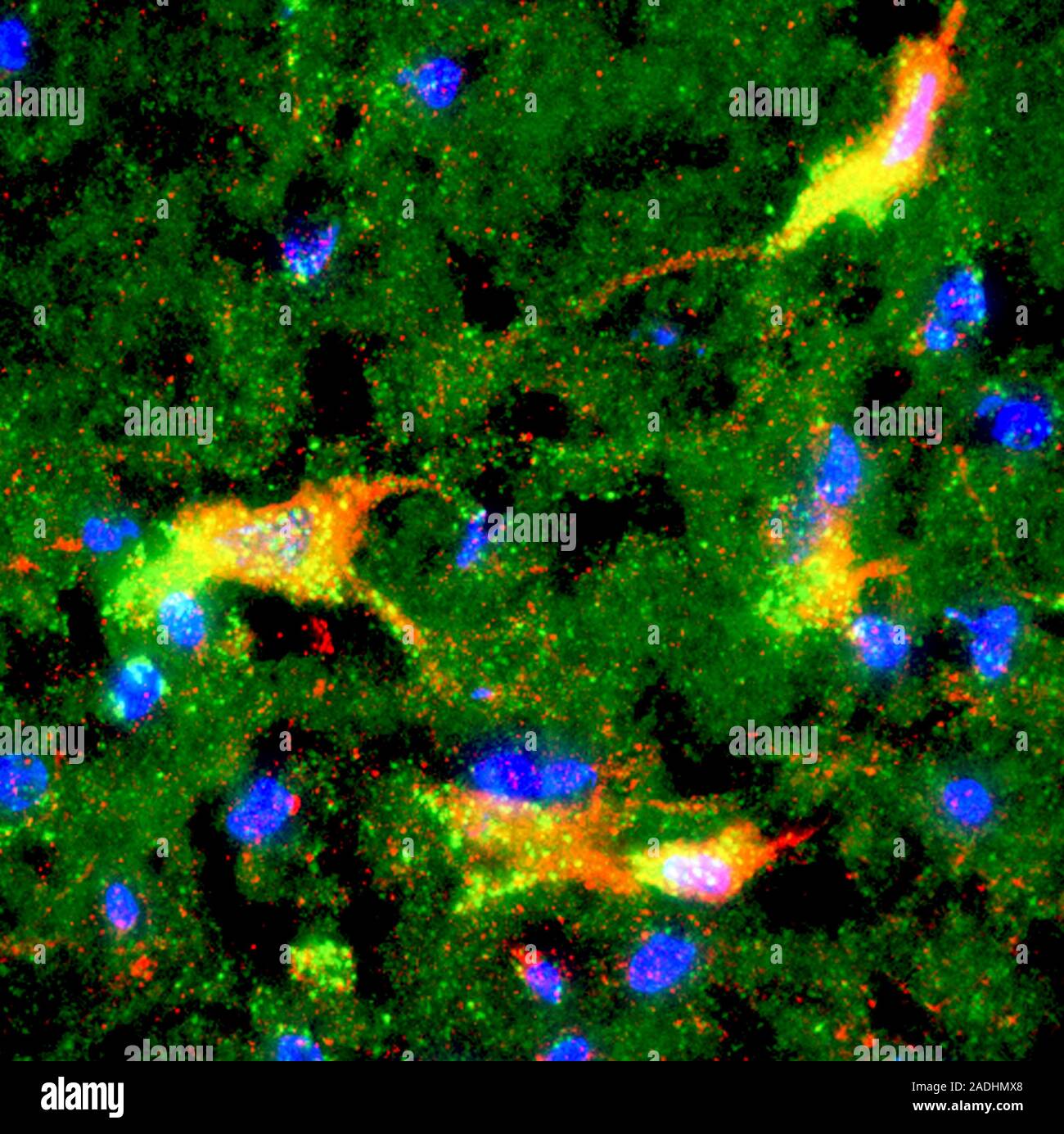 Brain protein in Parkinson's research, fluorescence deconvolution ...