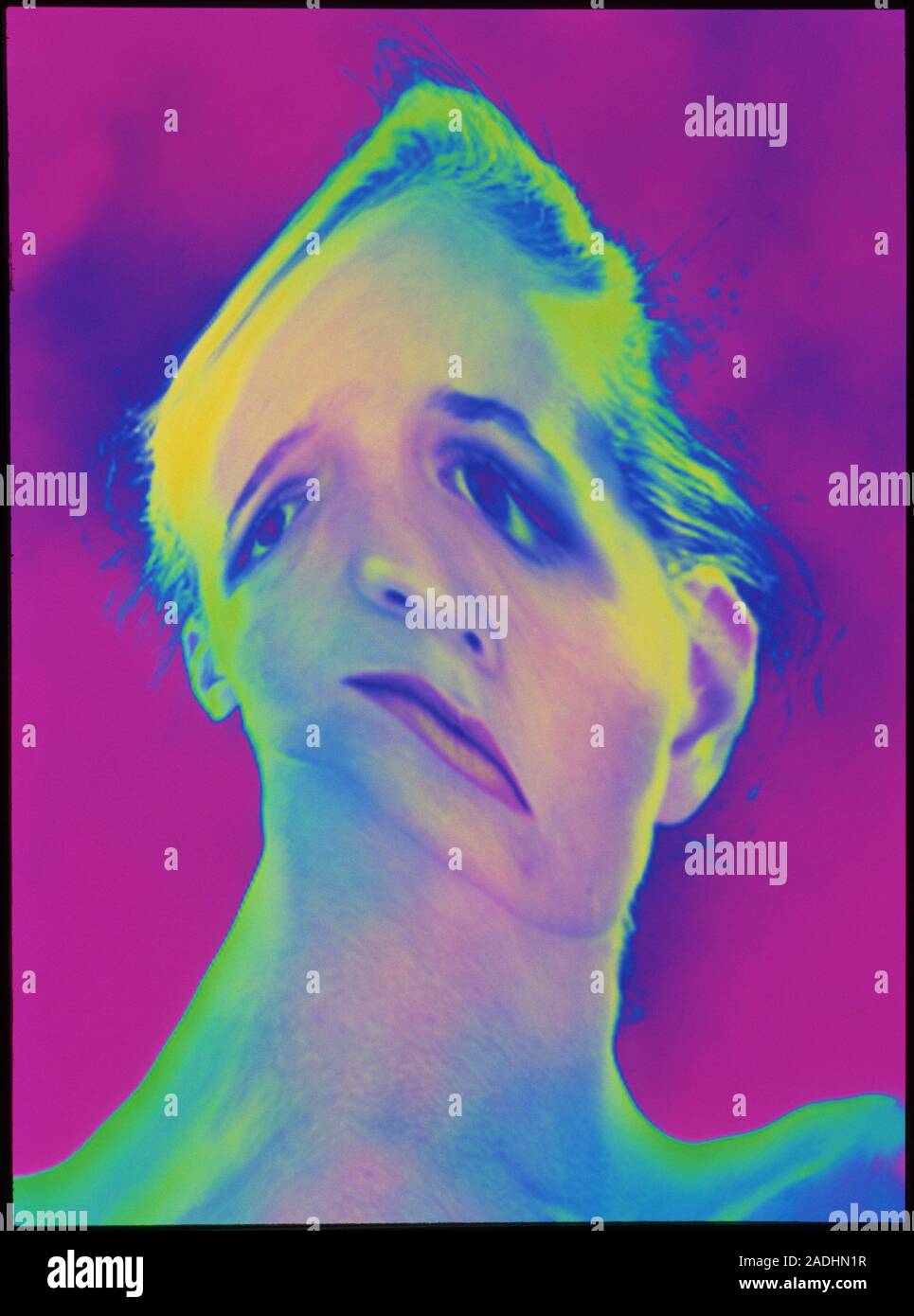 Mental disorder. Abstract computer image of the contorted face of a ...