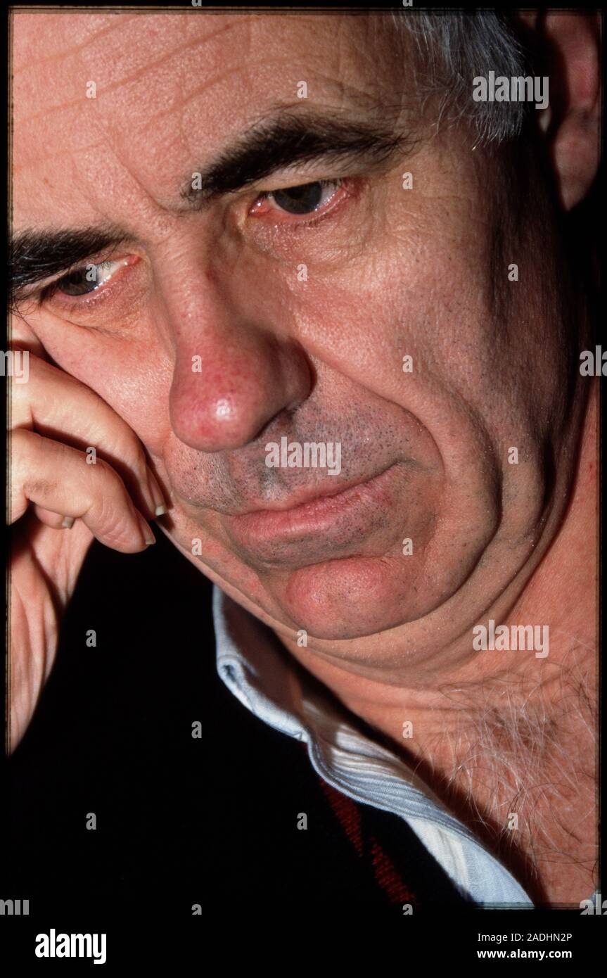 MODEL RELEASED. Depression. Close-up of the downcast, forlorn face of a ...