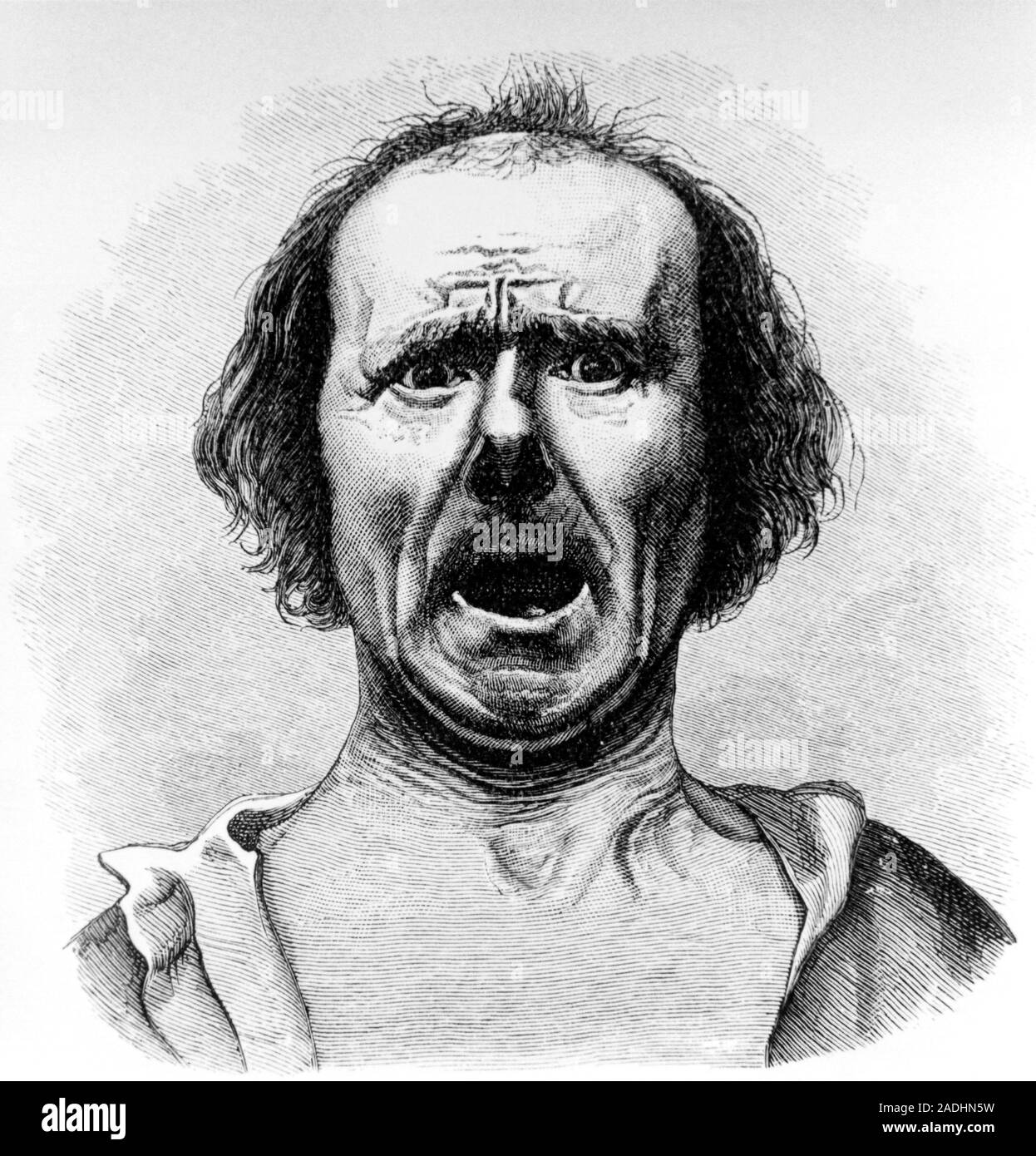 Horror. Engraving of a horrified man's face, taken from Charles Darwin ...