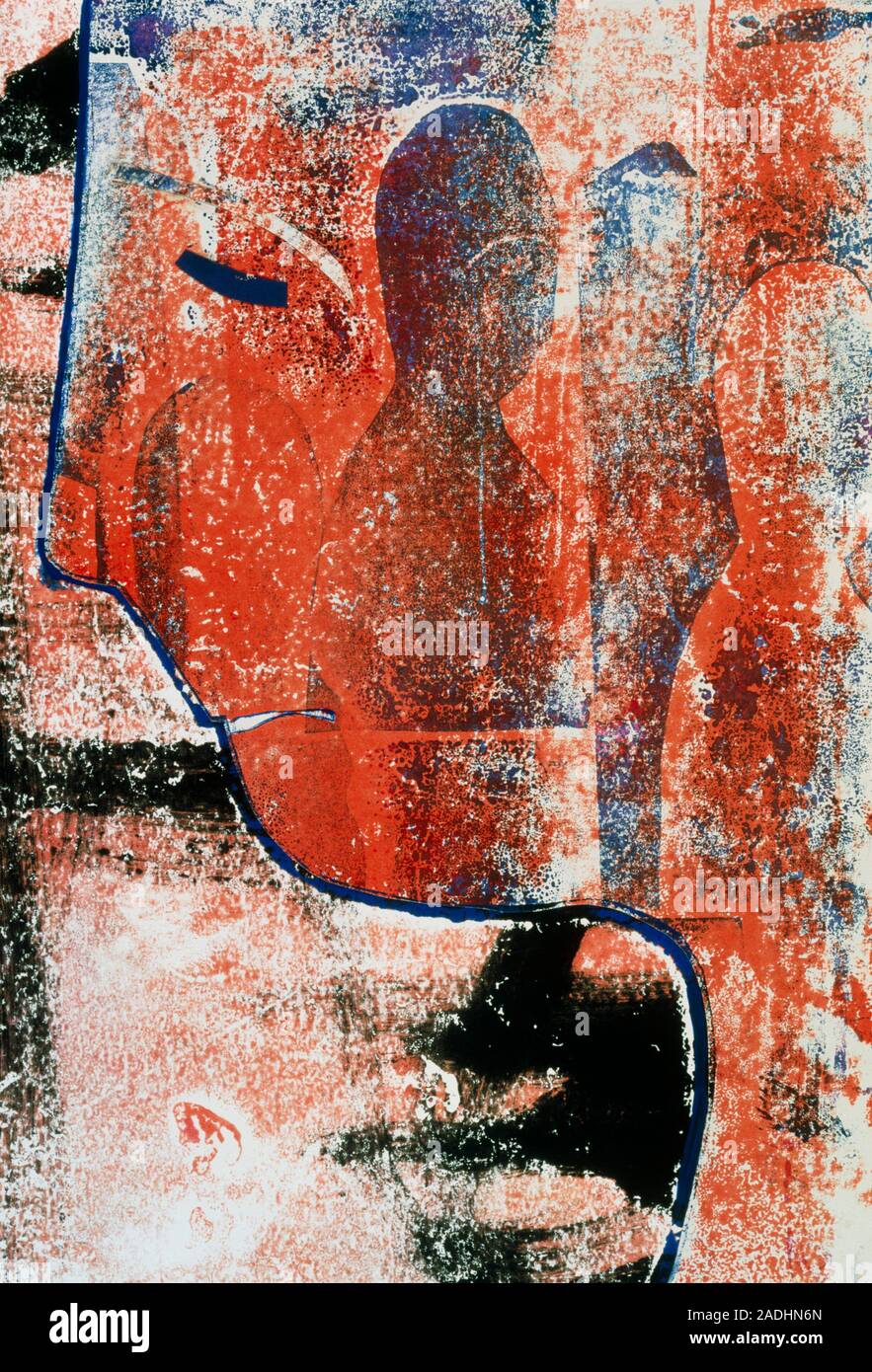 Schizophrenia. Abstract artwork showing the head and thoughts of a ...
