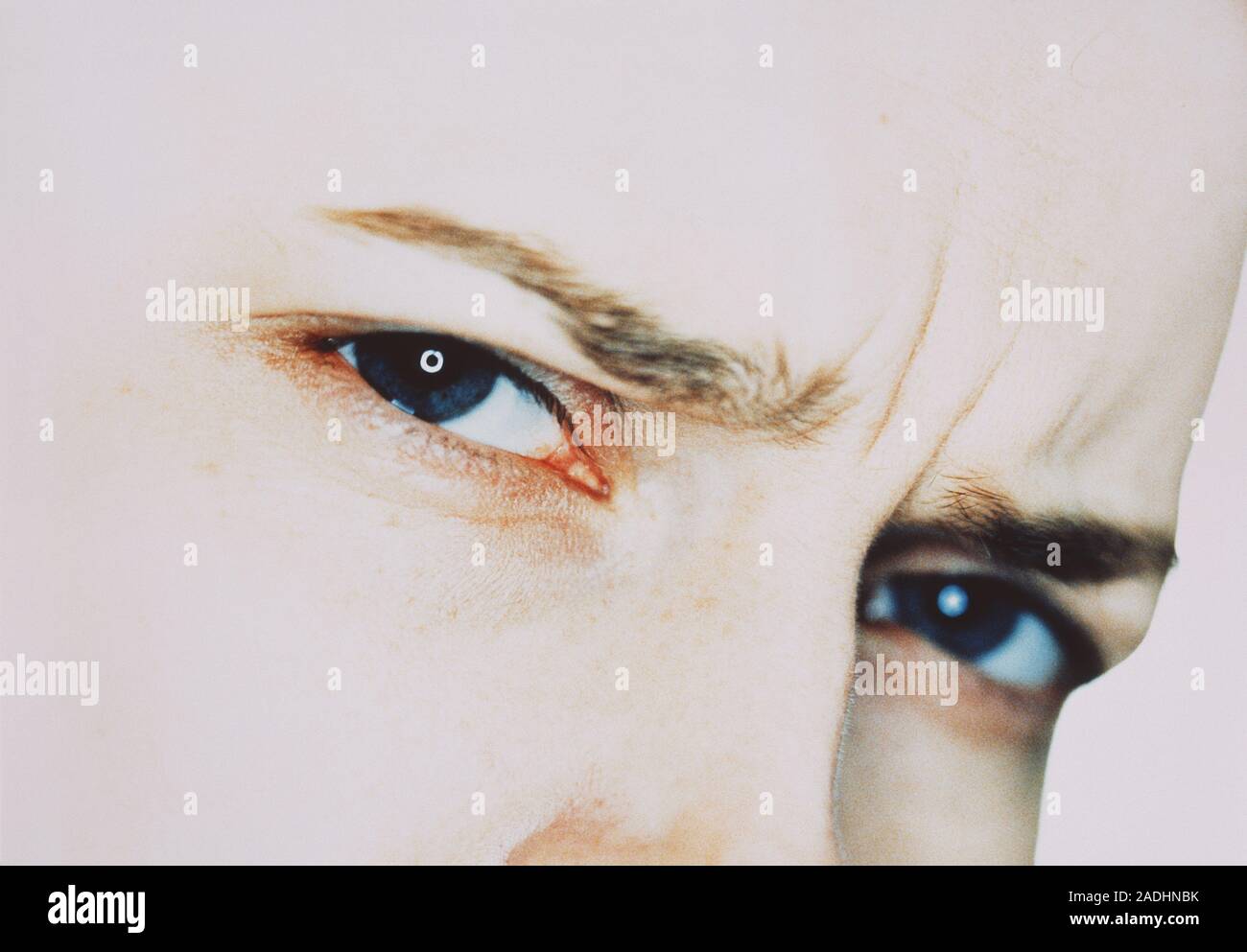 Puzzled woman's eyes Stock Photo - Alamy
