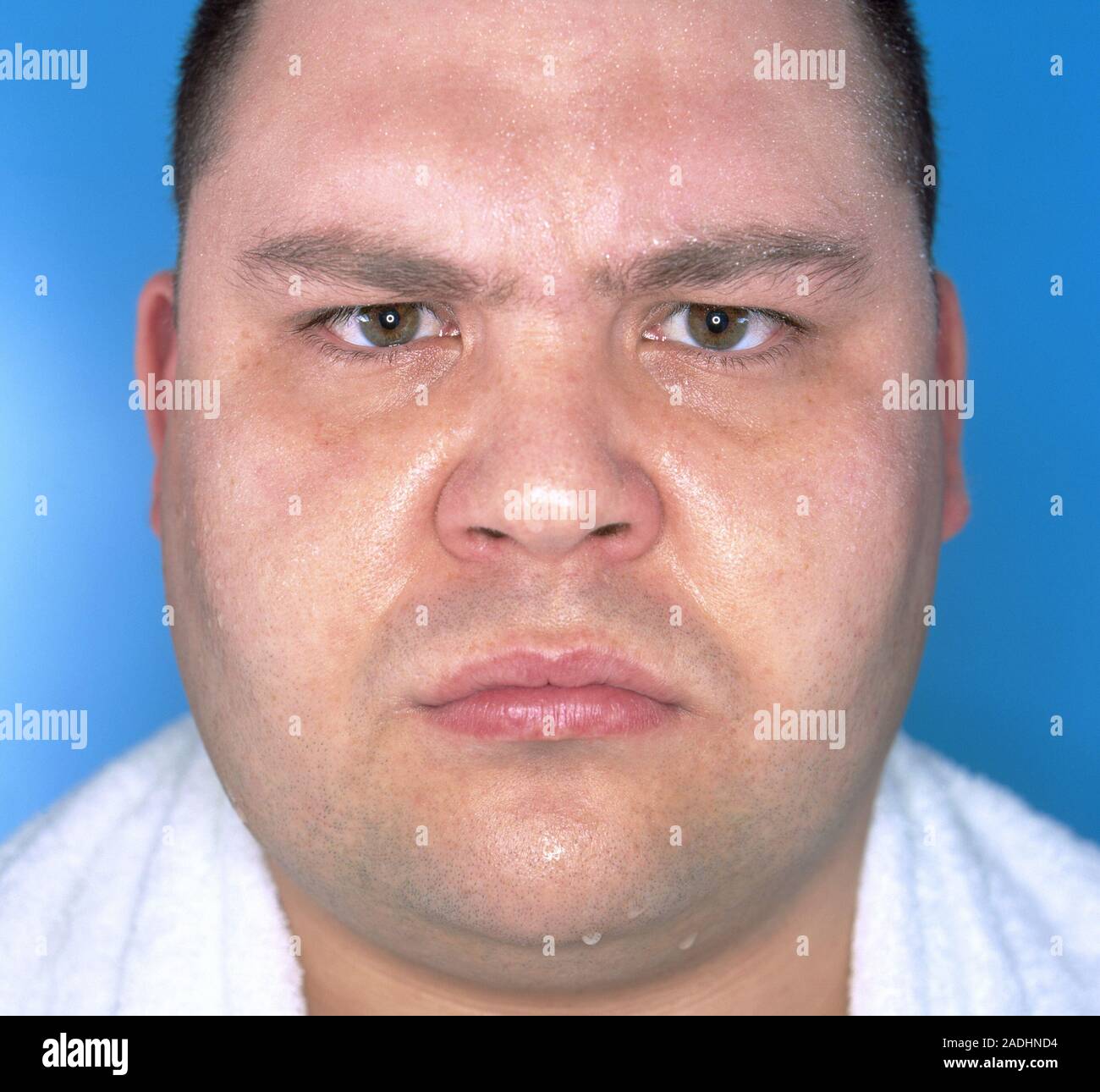 Anger. Sweaty face of an overweight man Stock Photo - Alamy