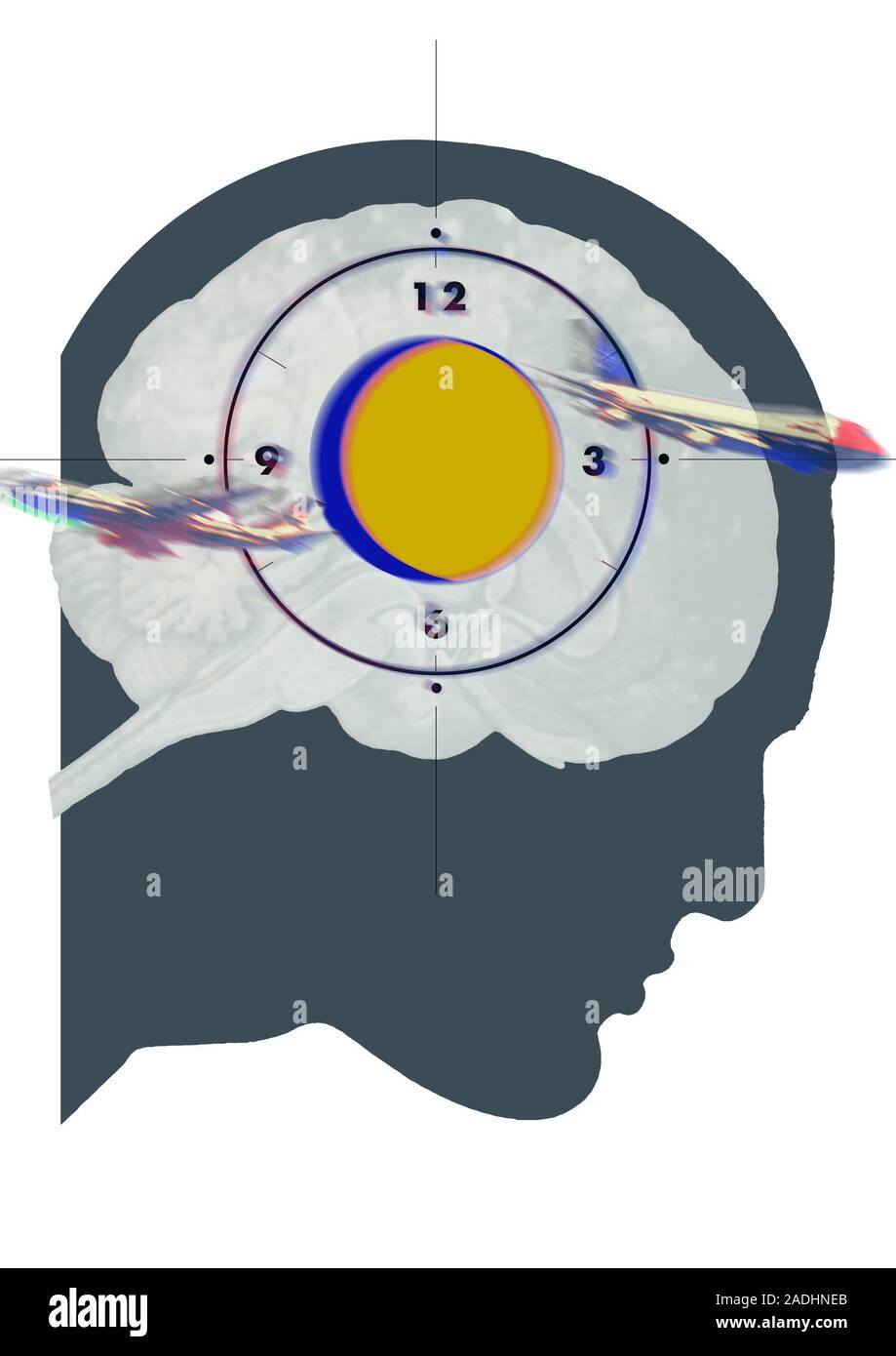 Jet lag, conceptual artwork. This could represent the tiredness and ...