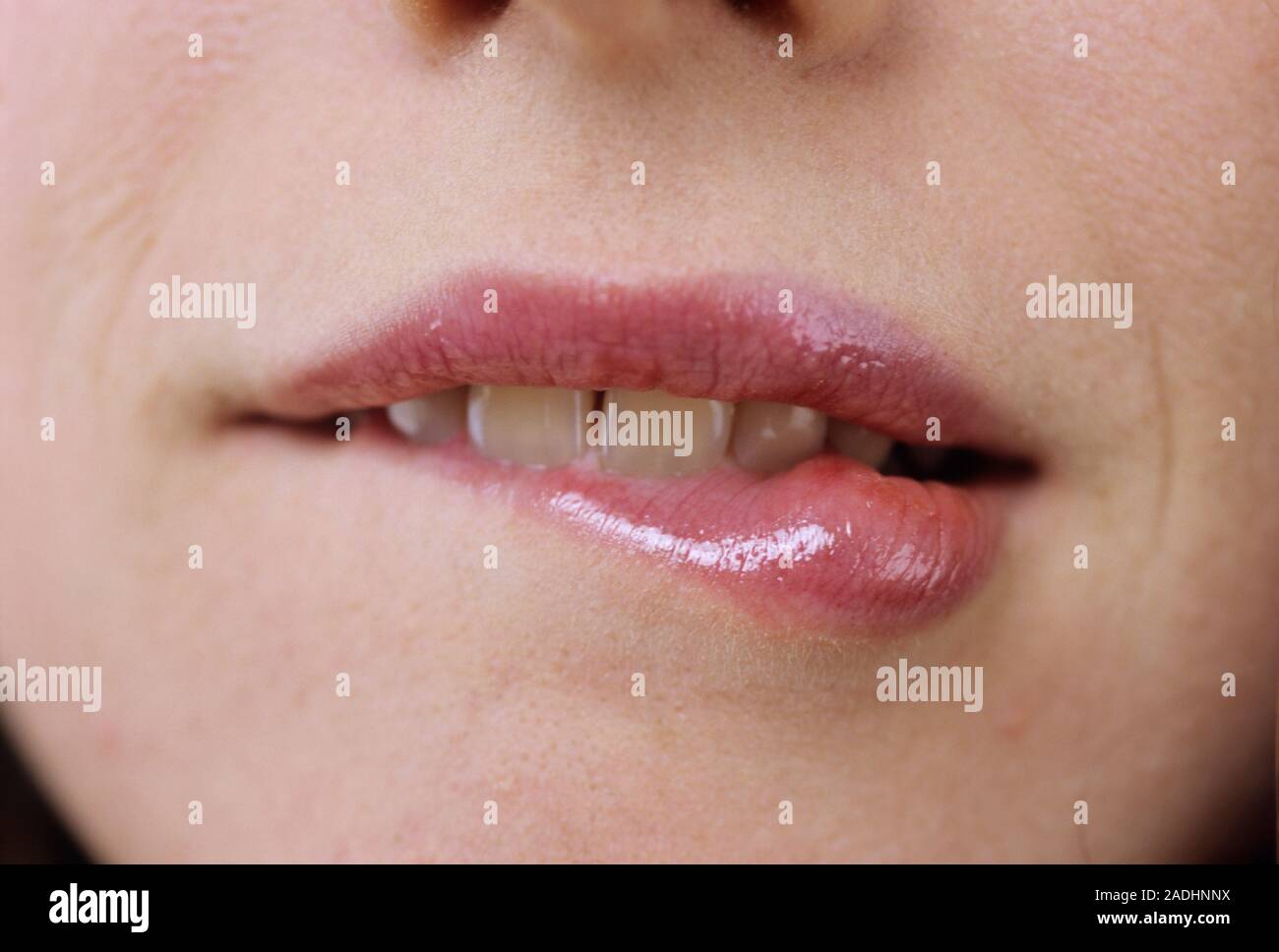 Woman biting her lip. Anxious young woman biting her lower lip Stock ...