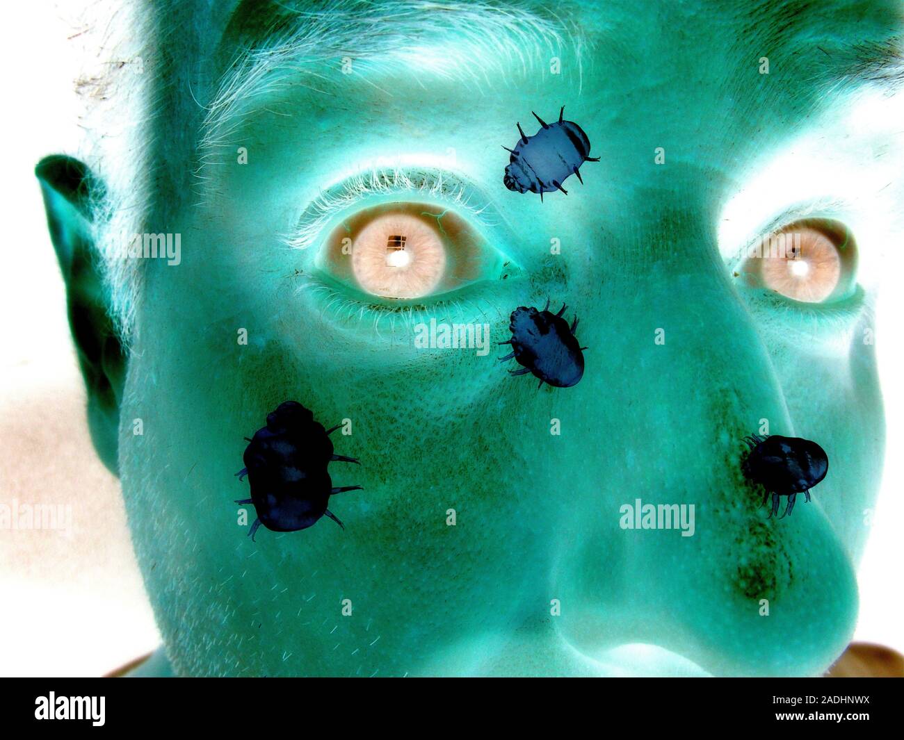 Delusional parasitosis. Conceptual artwork showing a man's face covered ...