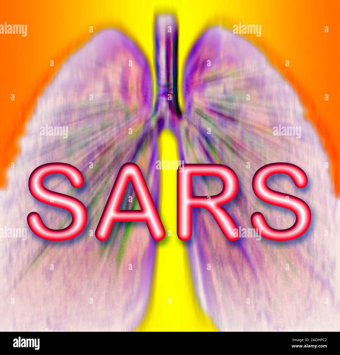 Severe acute respiratory syndrome (SARS). Conceptual image of the ...