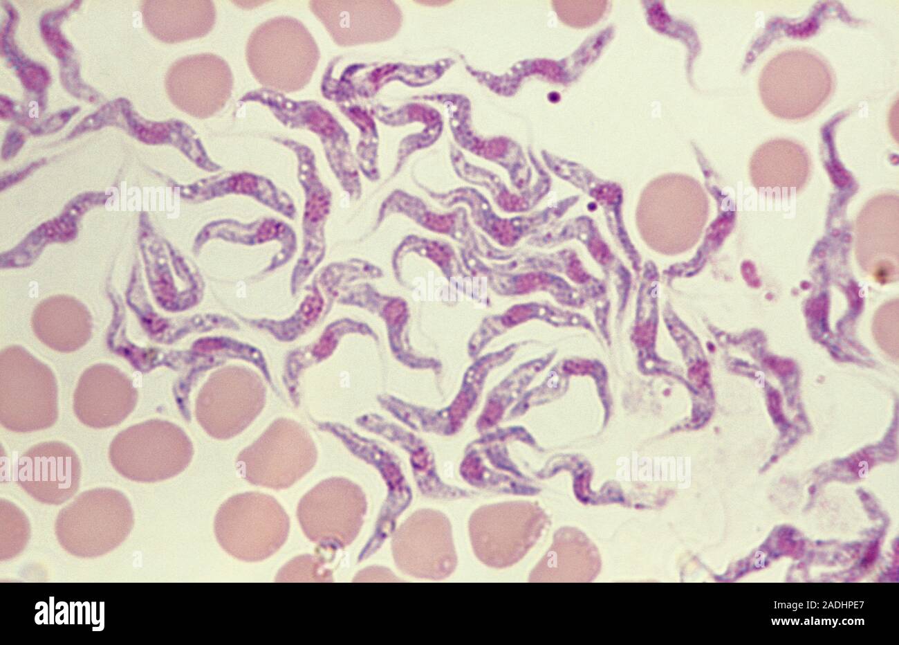 Sleeping sickness blood smear. Light micrograph of the blood of a ...