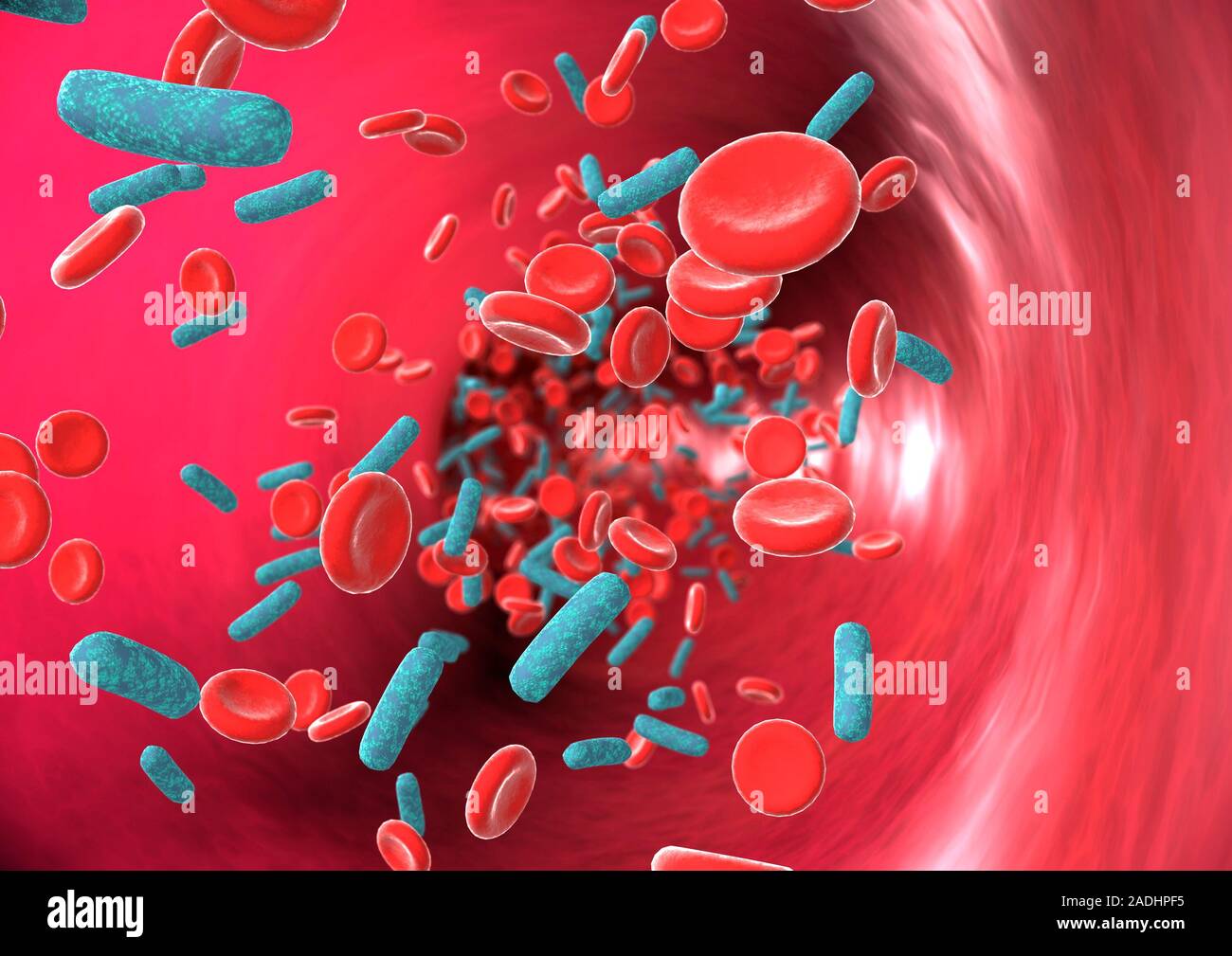 Blood poisoning. Computer artwork of bacteria (blue) in the bloodstream ...