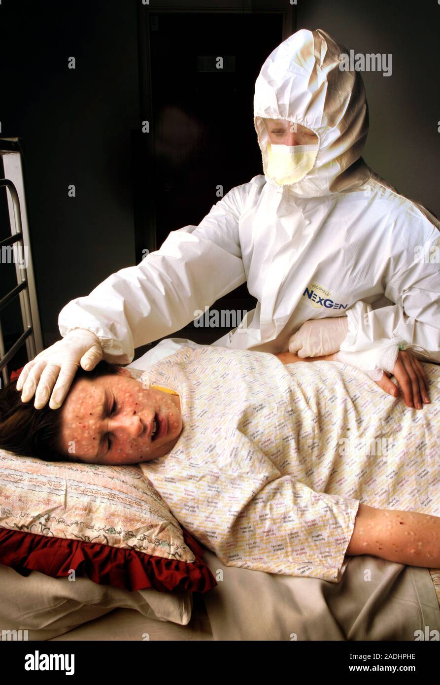MODEL RELEASED. Smallpox infection. Simulation of a doctor stroking the ...