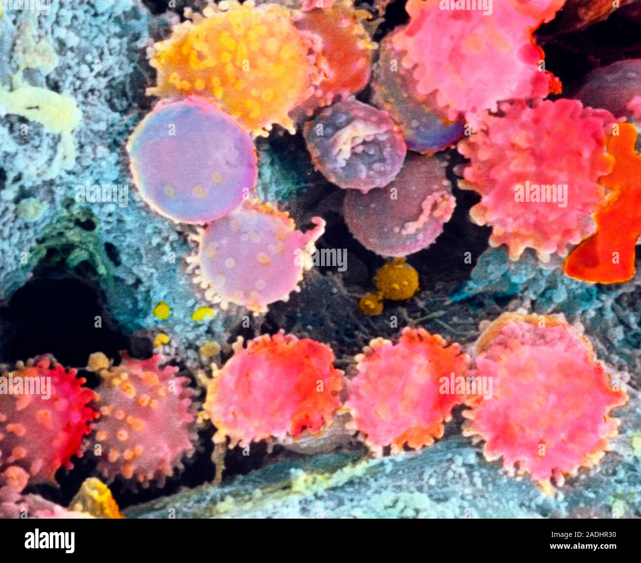 Red Blood Cell Morphology Echinocytes