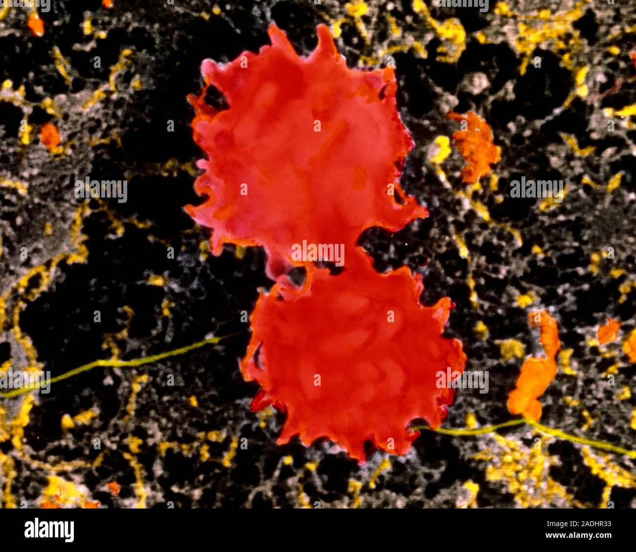 Red Blood Cell Morphology Echinocytes