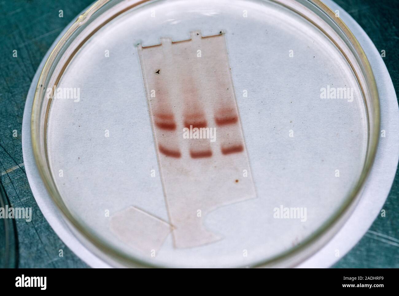 Dengue mosquito genetics. Electrophoresis gel showing the results of ...