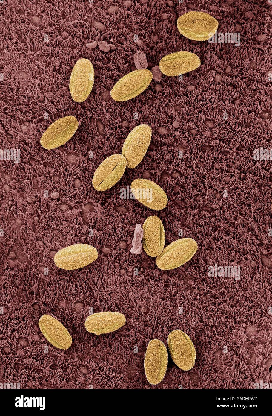 Allergens in trachea. Coloured scanning electron micrograph (SEM) of ...
