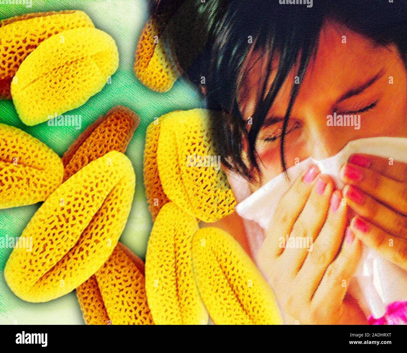 MODEL RELEASED. Hay fever. Composite image of a woman sneezing and ...