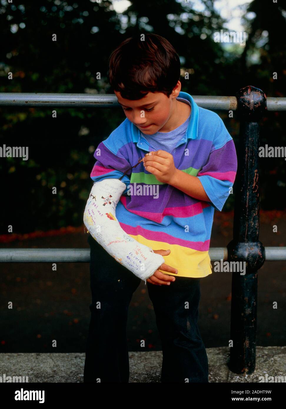 Model released. Young boy with a fractured arm which resulted from a ...