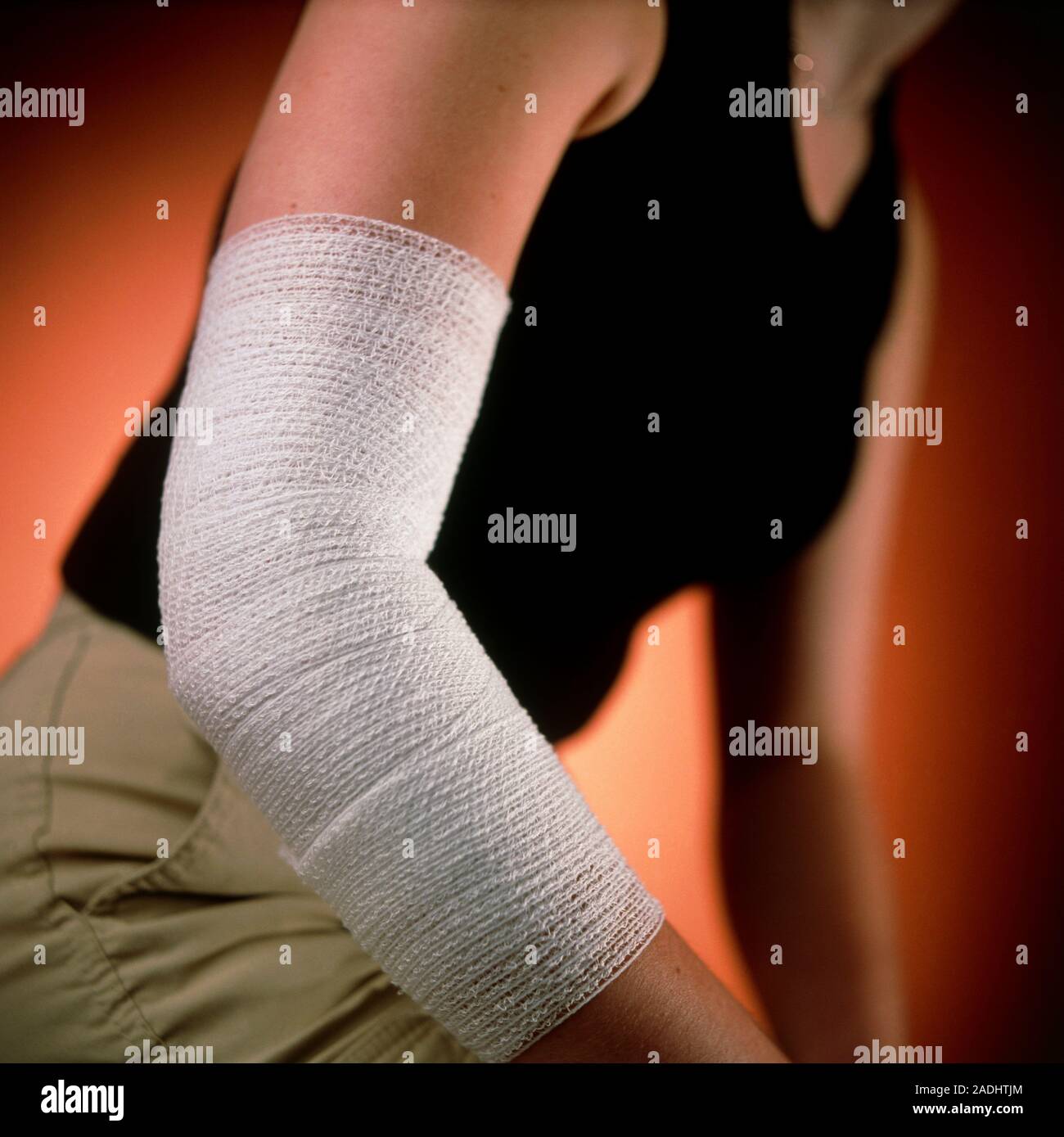 Bandaged elbow. View of the bandaged elbow of a young woman. Bandages ...