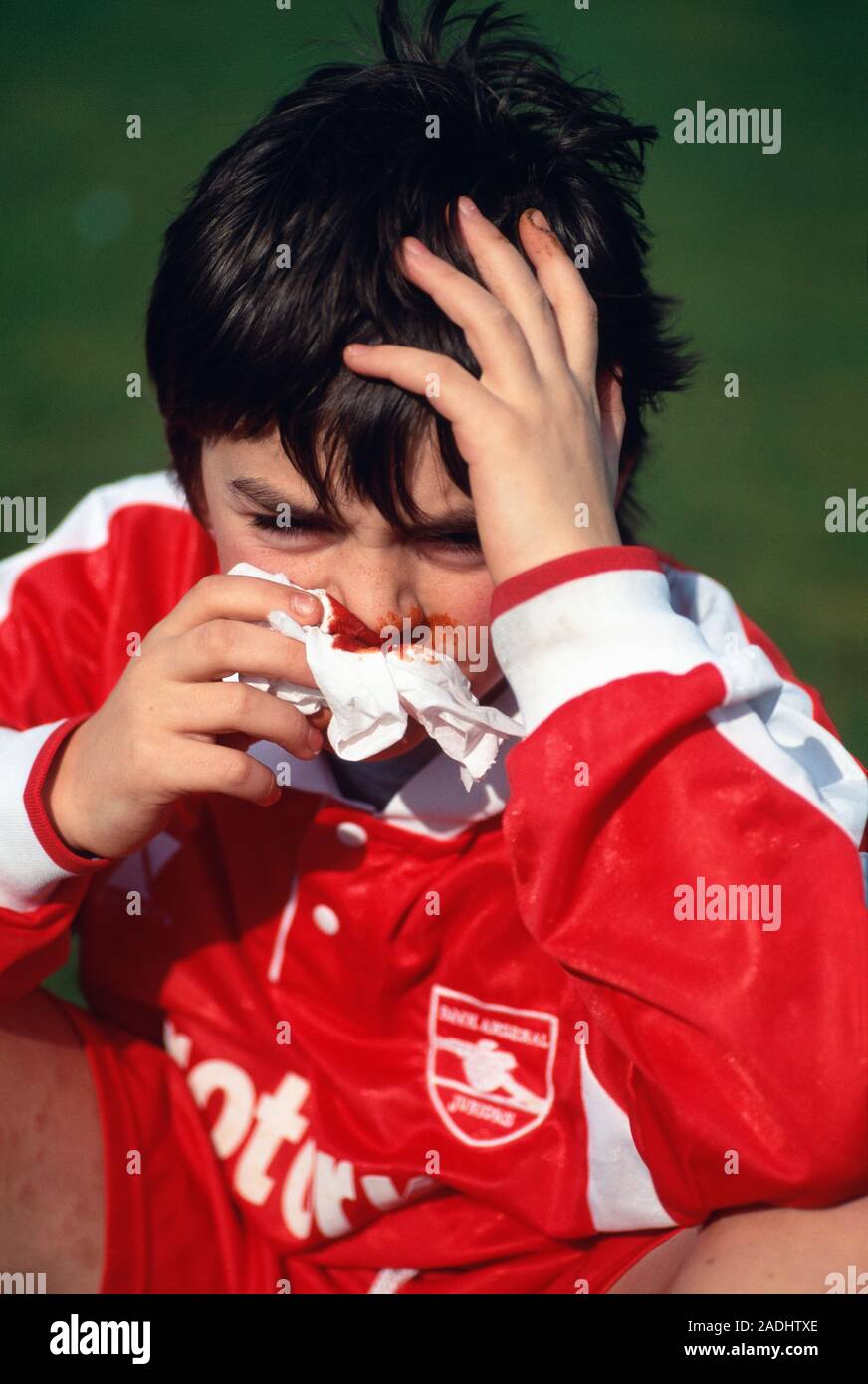 Nosebleed. Ten year old boy holding a tissue to his nose to staunch a ...